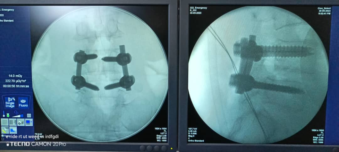 Surgery, Orthopedics and Trauma Management – Juba Medical Complex